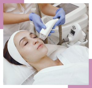 Micro needling radio frequency - Fab Skin Hair & Laser